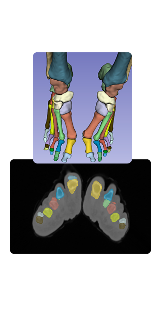 MLOps for Medical Imaging | MedCAD Case Study